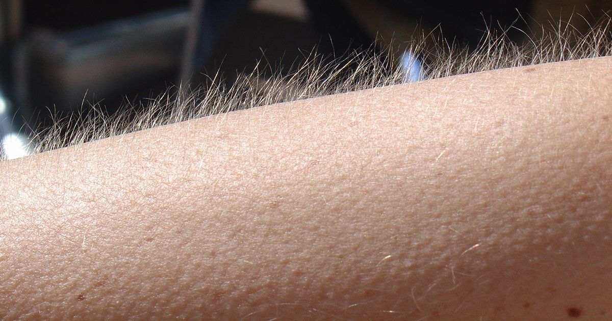 Medical Terms for Mundane Problems Quiz - By timschurz