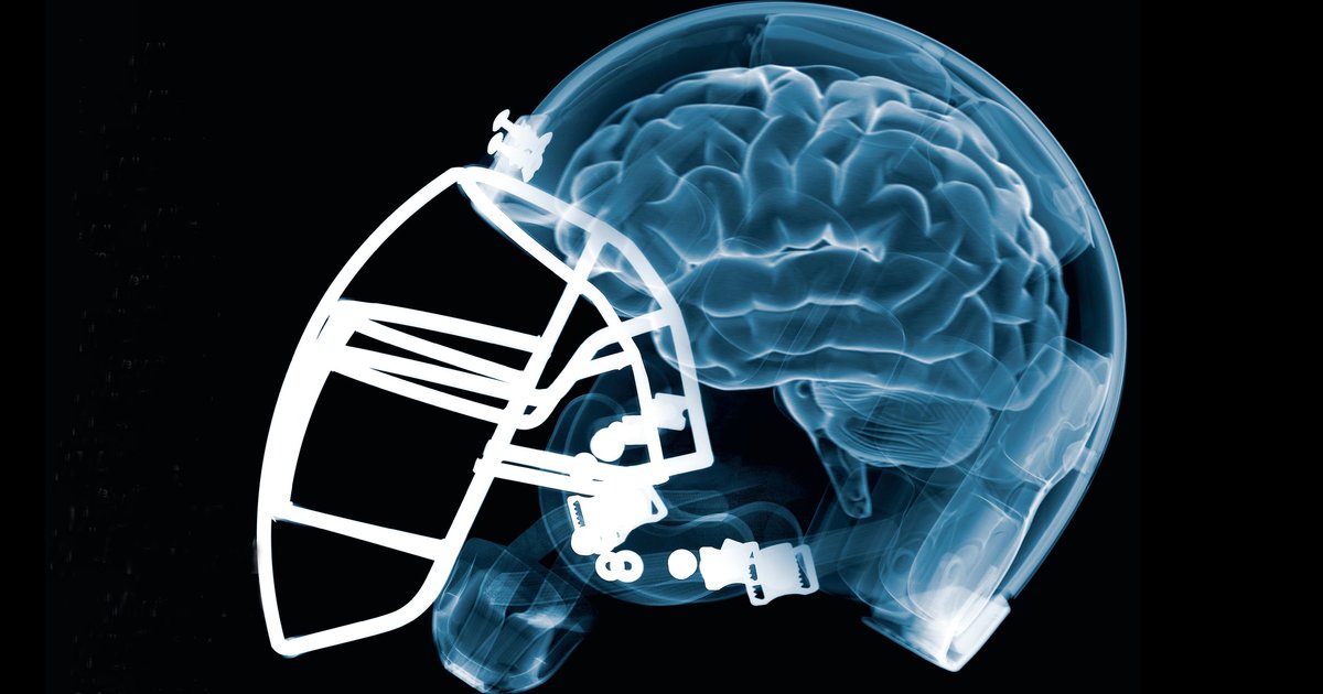 NFL Logic Puzzle Quiz - By kjl1313