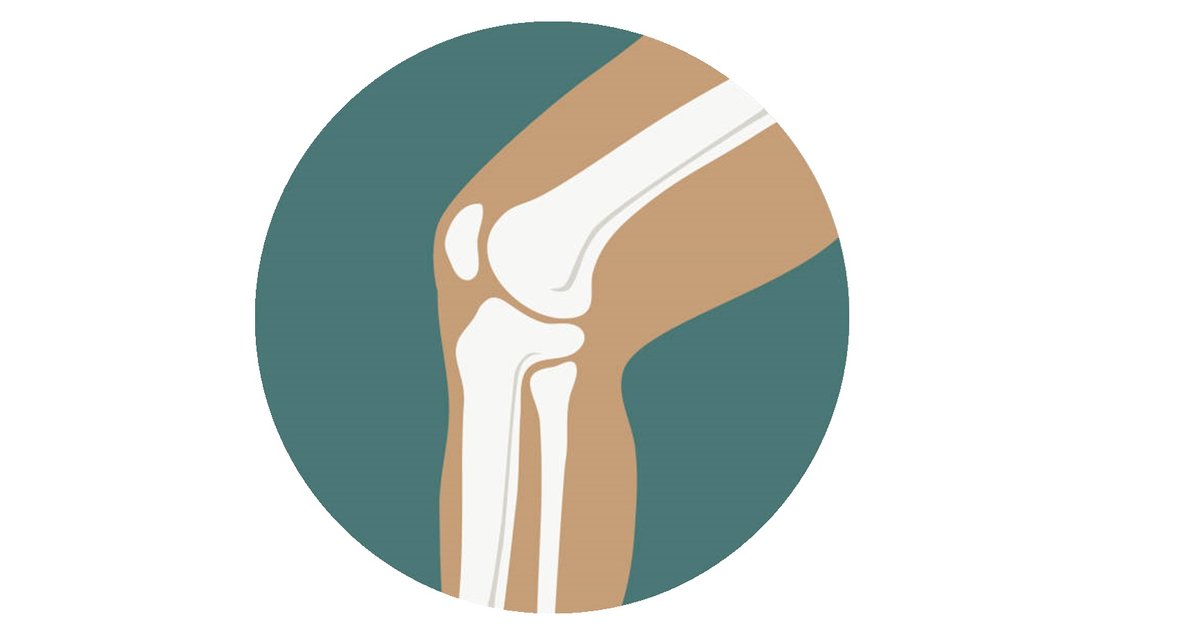 Anatomy of the Patella Quiz - By Hannahmat