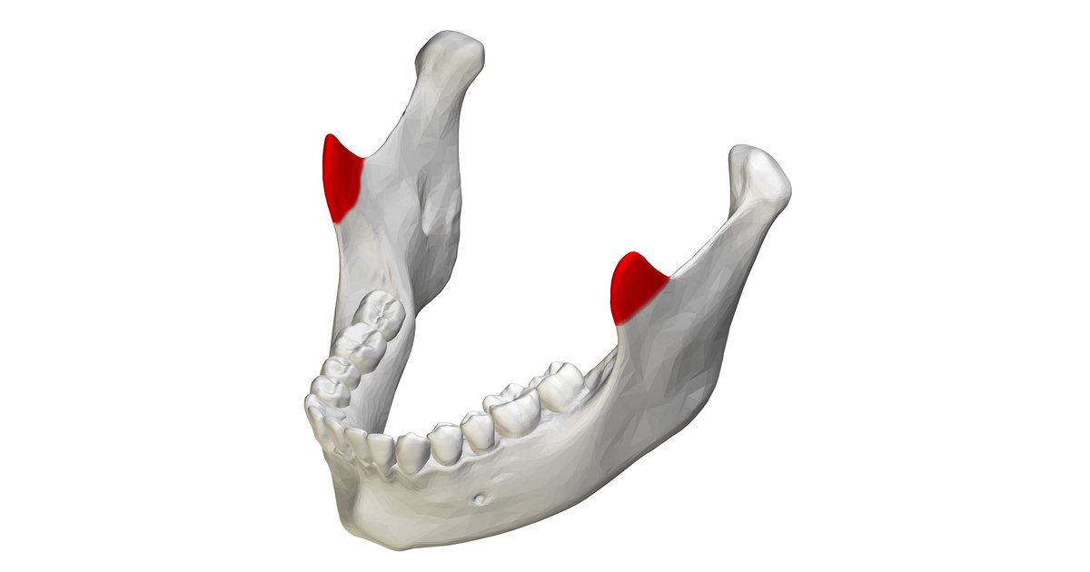 1 Minute Bones: Conoid, Coronoid, or Coracoid? Quiz - By Hannahmat