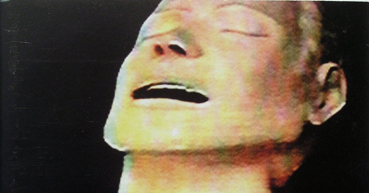 Order Up - The Bends by Radiohead Quiz - By tomsoadlewis